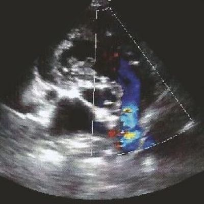 Kardiologie